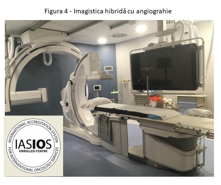 Tehnici inovatoare de tratare cancer – eMedic.ro